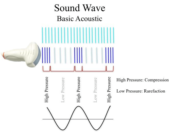 Internal Medicine Point of Care Ultrasound - IMPoCUS