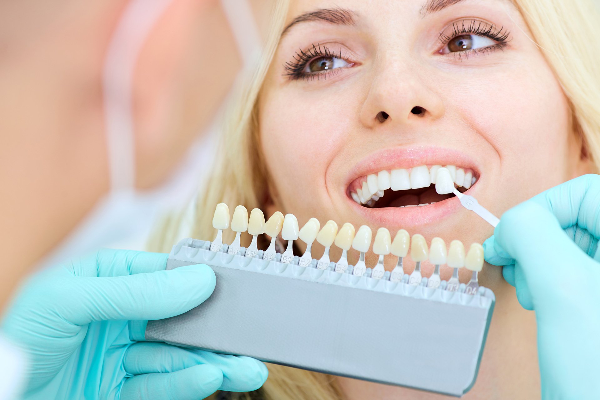 Repair of Fractured Teeth, McKenna Dental » Treatment Options, McKenna ...