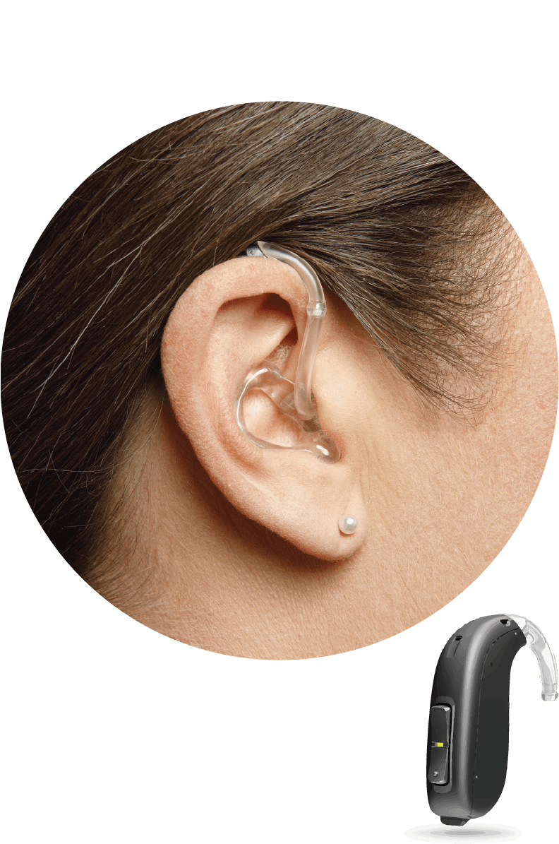 Acoustic Audiology | Hearing Aids