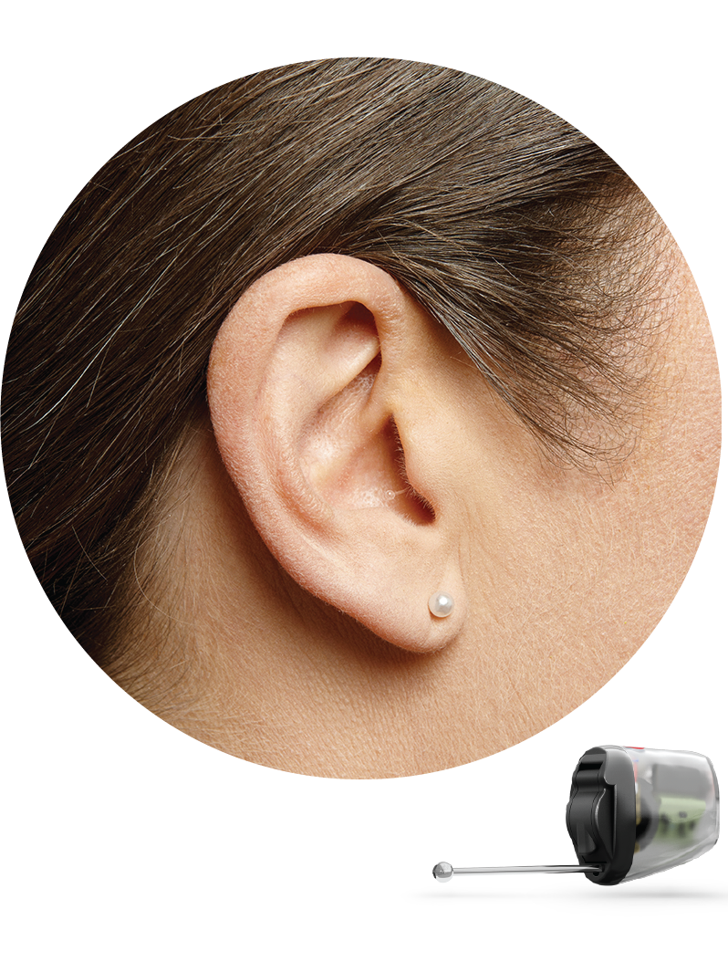 Acoustic Audiology | Hearing Aids