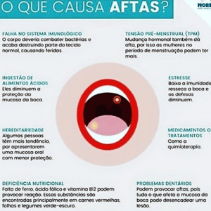 Aftas: um problema comum e persistente