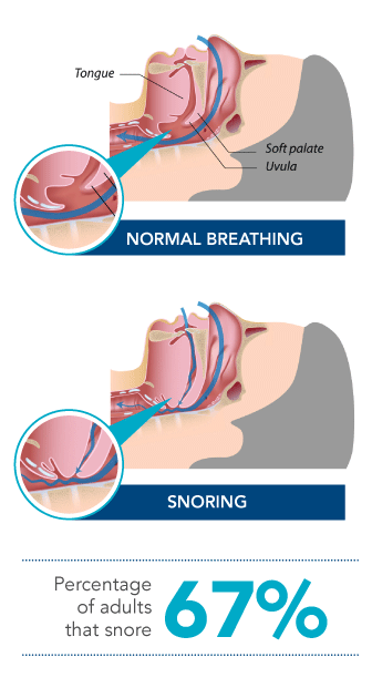 Solea Sleep | J. Steven Banks, DDS