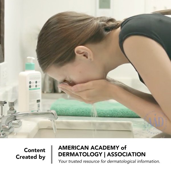 Acne | Frontline Dermatology