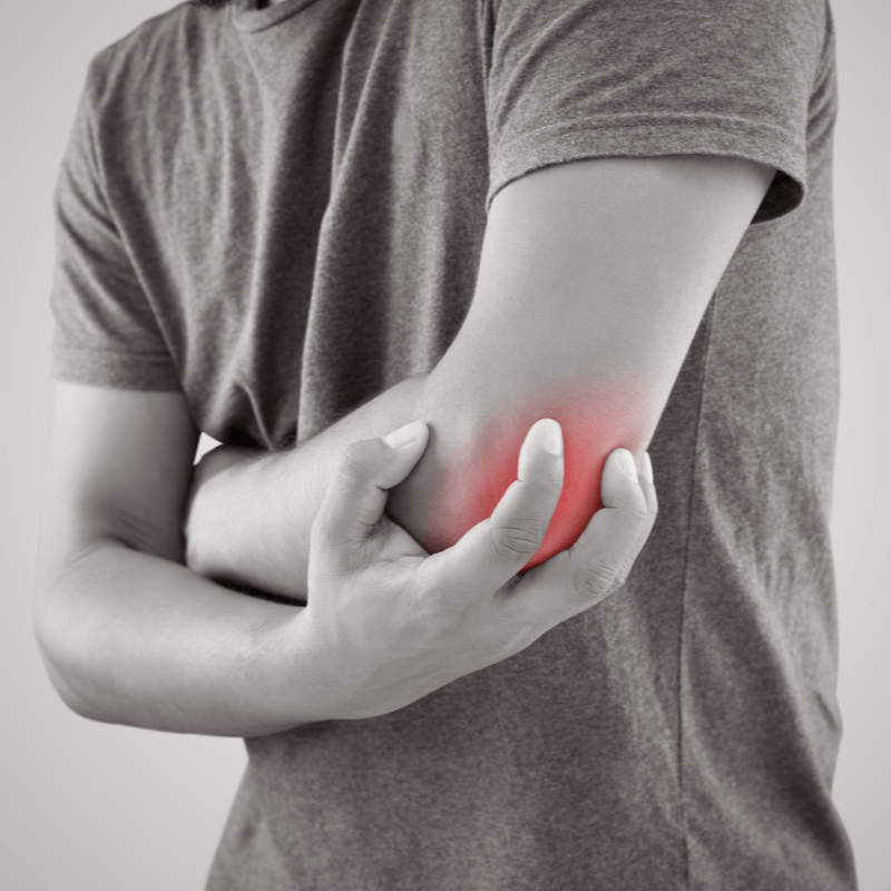 What is Dry Needling?