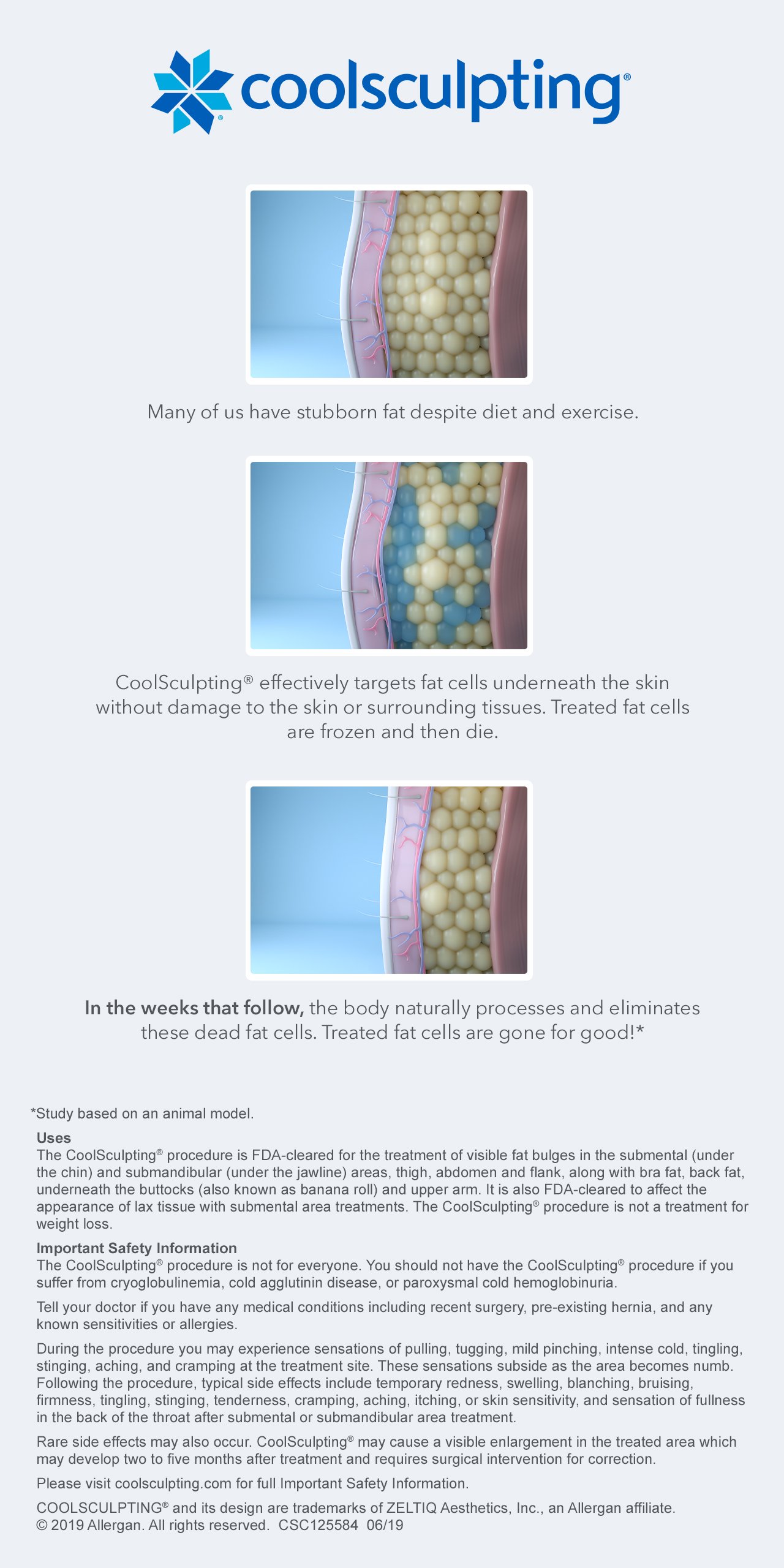 California Coastal Dermatology | Coolsculpting