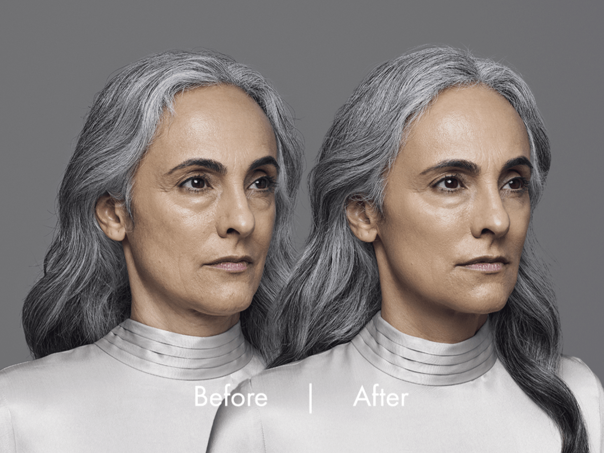 California Coastal Dermatology | RHA® Collection