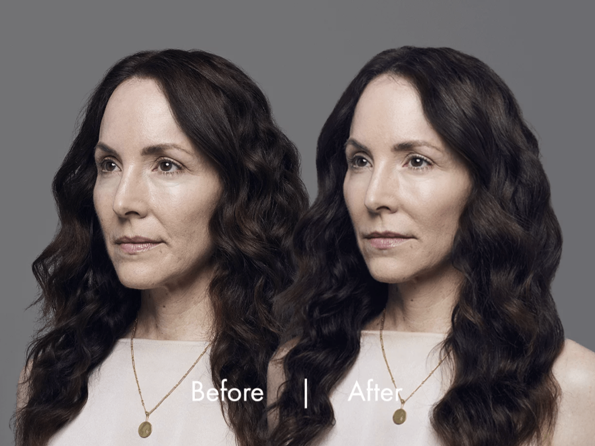 California Coastal Dermatology | RHA® Collection