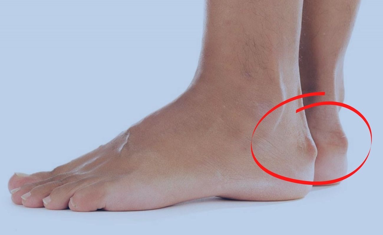 Cura patologie del piede | Torino | Plantari.it