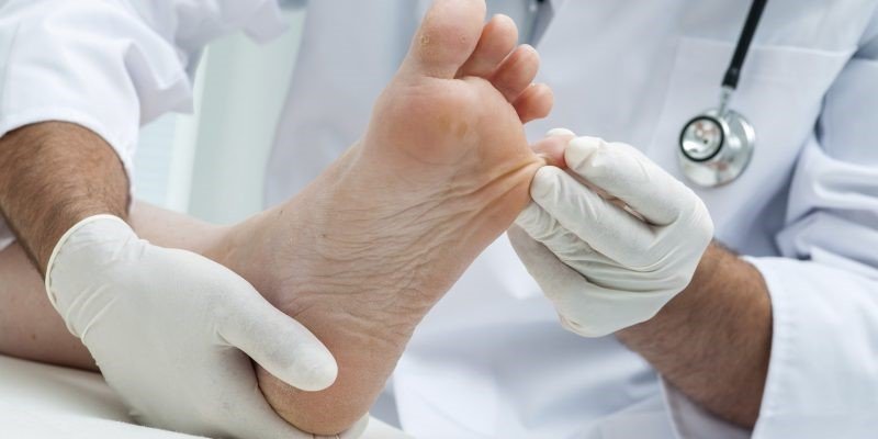 Affordable podiatry treatments across Northern Ireland