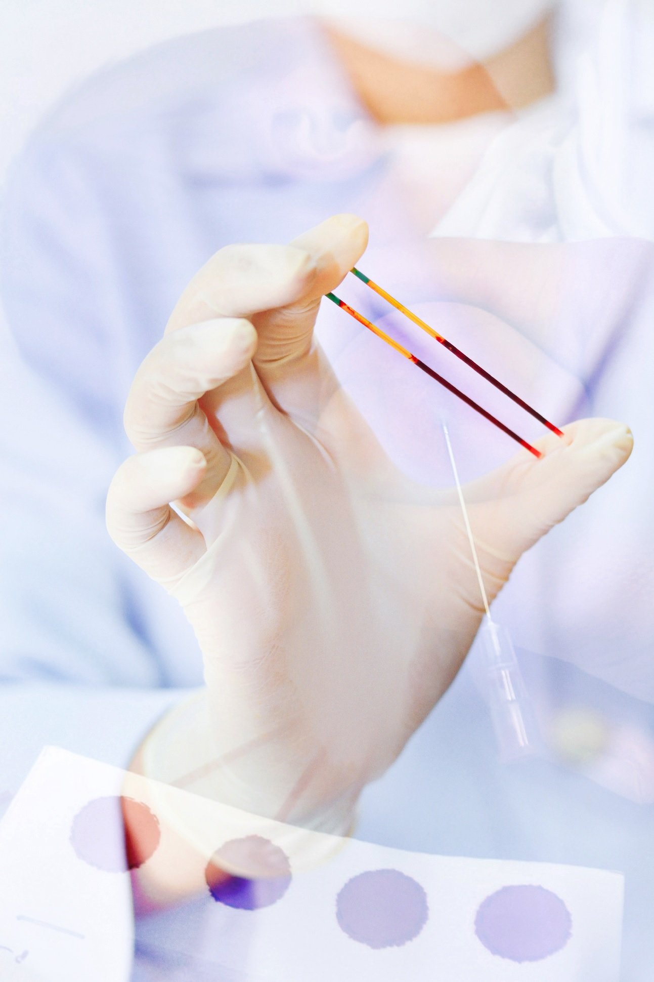 Luxon Distributor for Labs | LDTD Ion Source