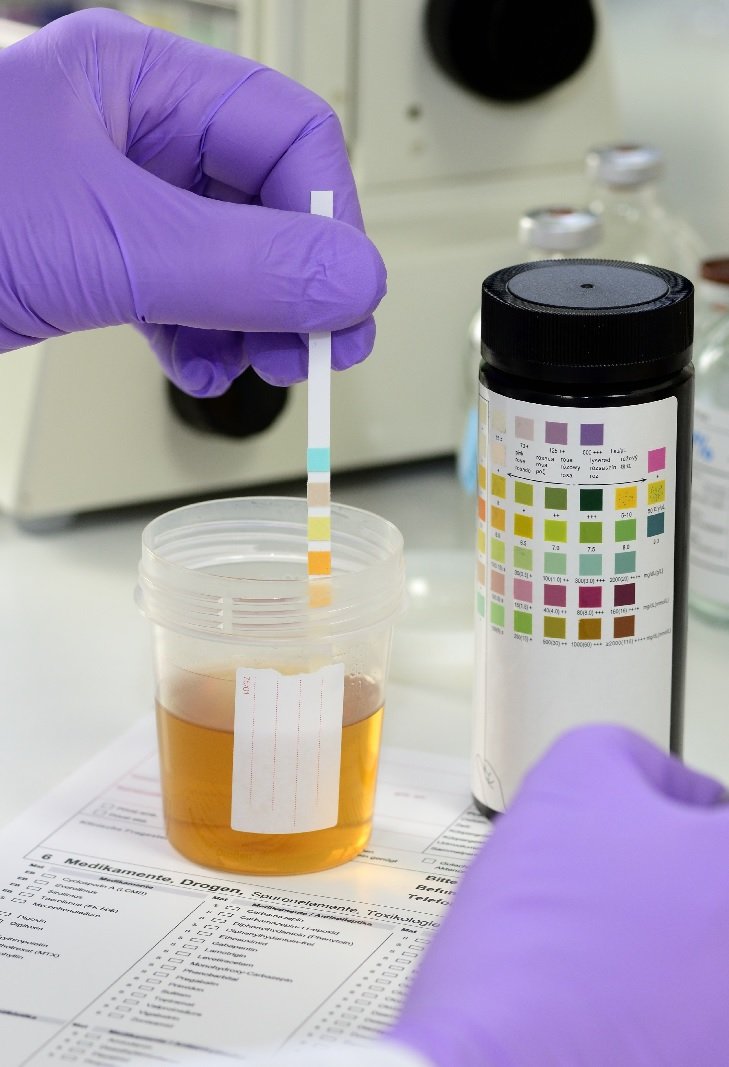 Luxon Distributor for Labs | LDTD Ion Source