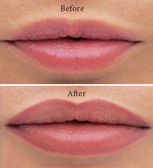 Semi Permanent Makeup Solutions In Reading At Hayley Hinton
