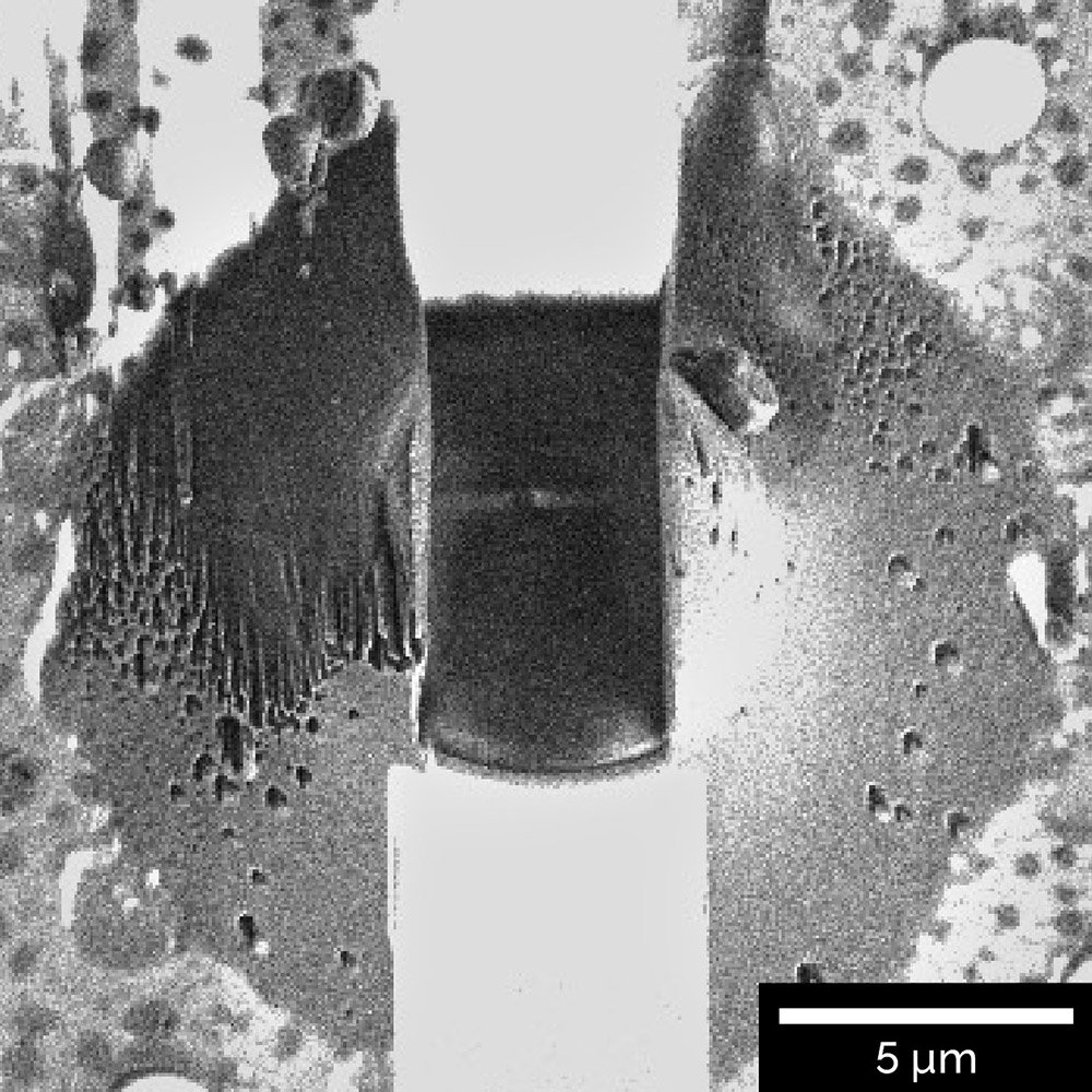 High resolution electron microscopes with x ray, and microtomography