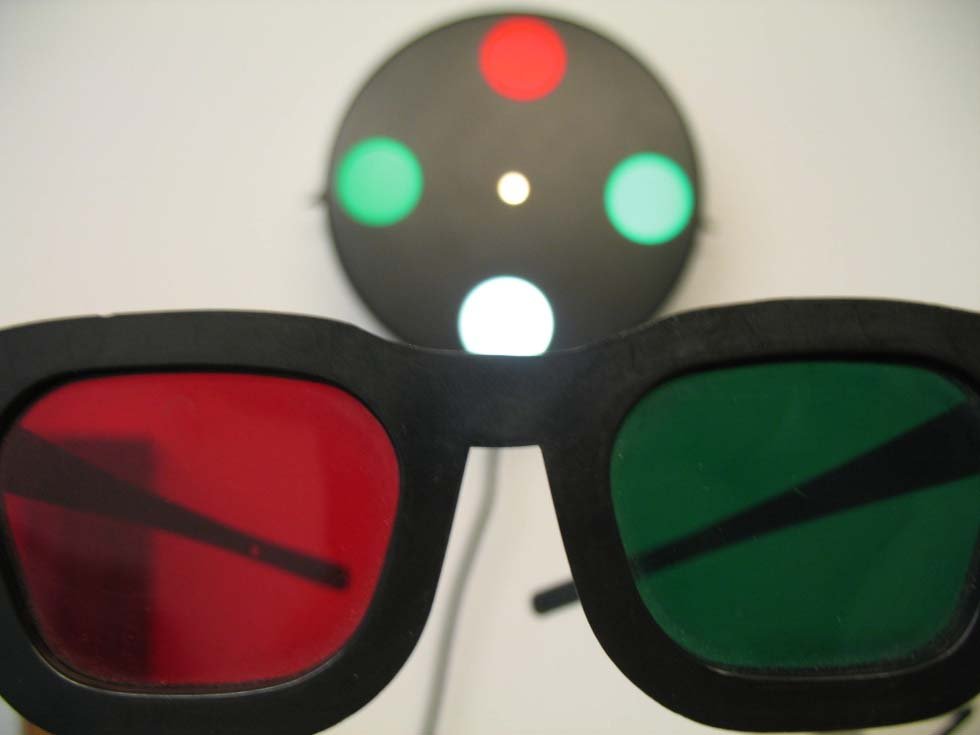 Visita Oculistica | Padova | Dott.ssa Tormene