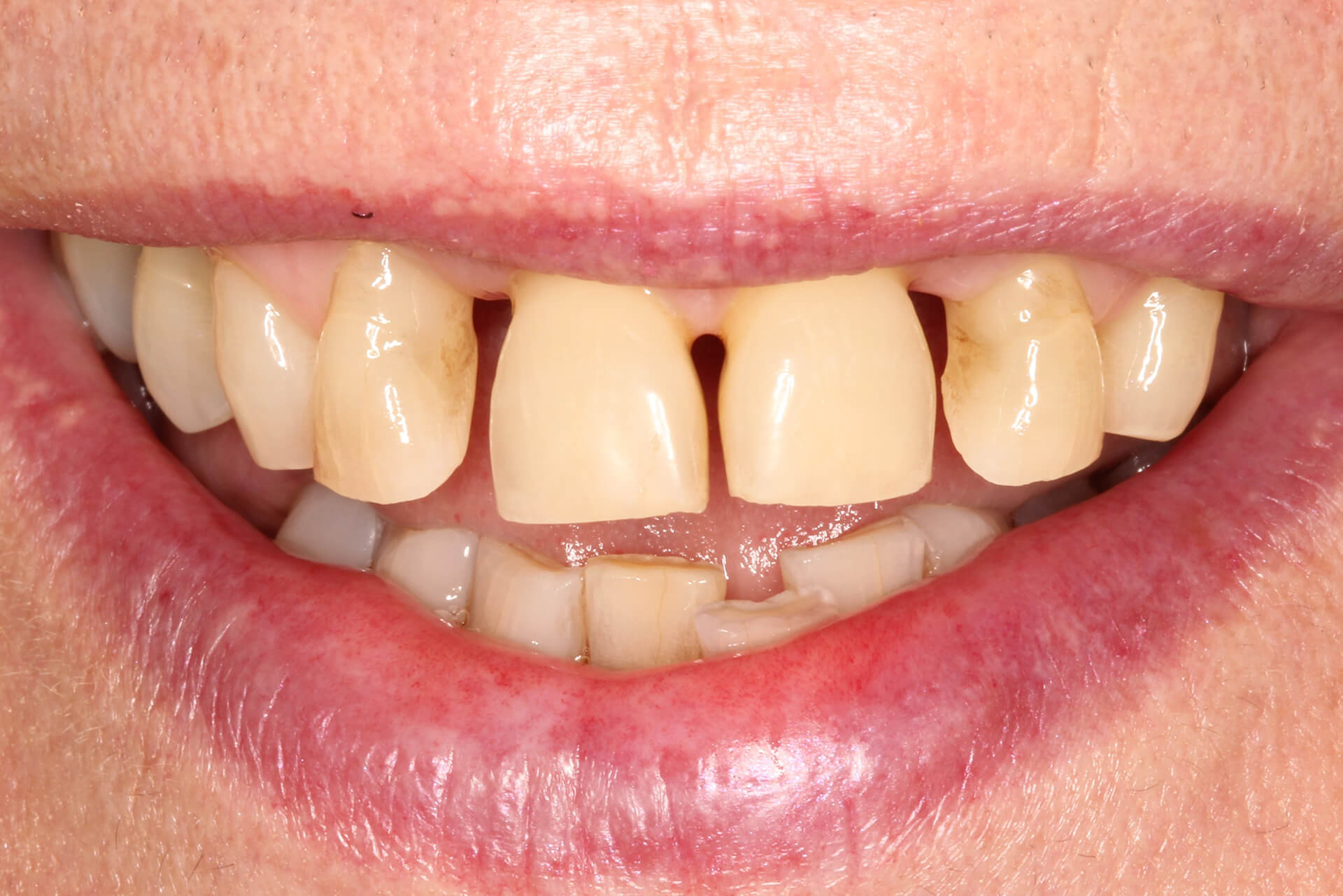 Our Before & After Smile Gallery | Pall Mall Dental