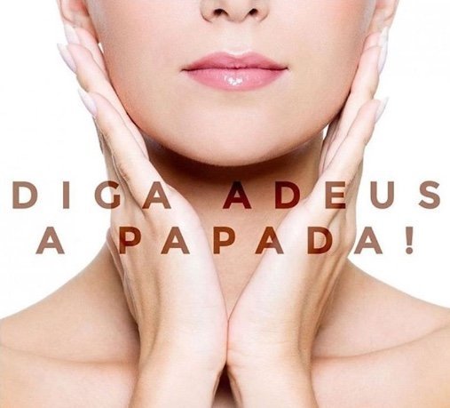 Lipo de Papada Fortaleza-CE | Reduza sua gordura sem cortes e sem dor