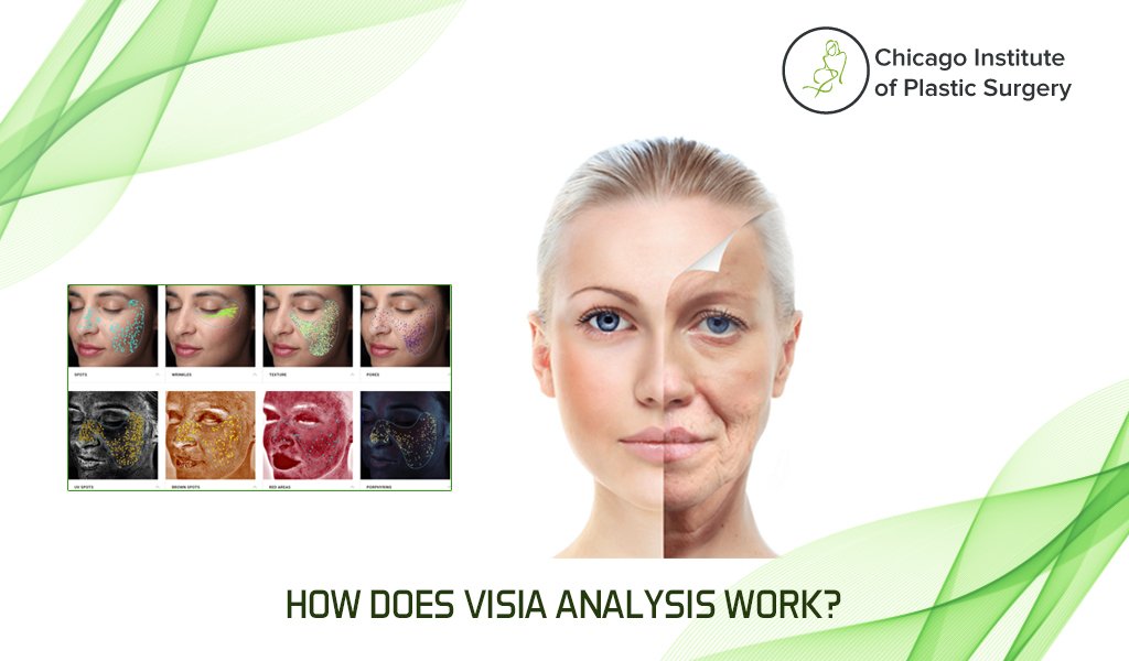 What is the VISIA Skin Analysis | How Does Visia Analysis Work | Key ...