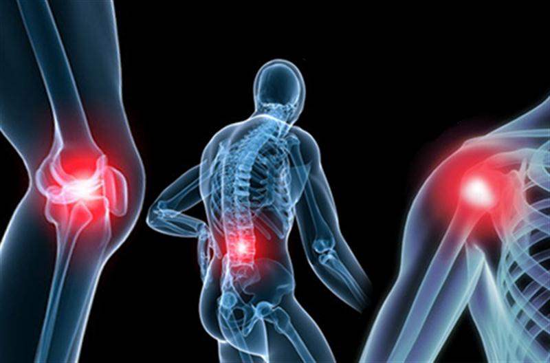 Osteoarthritis (OA) and Exercise