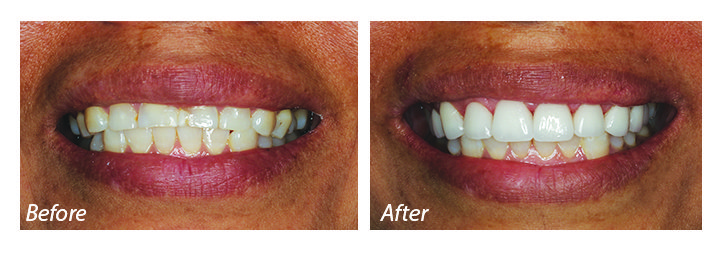 Smile Gallery in Hempstead, Country Smiles Dental