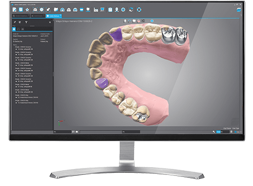 Dental Lab Digital Technology | Hershberger Dental Lab