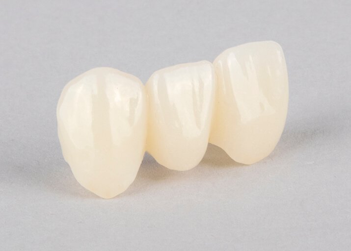 Multilayered Zirconia | Hershberger Dental Lab