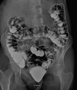 Radiologia - Salerno - C.R.T.F.