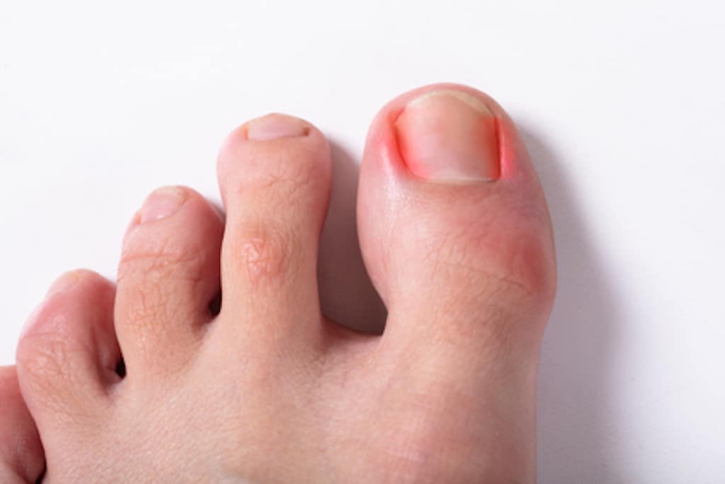 Why is my toenail so painful?