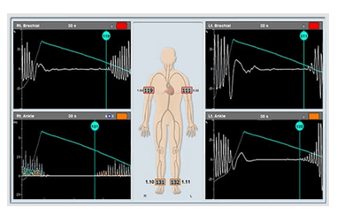 Viasonix Falcon Pro | Peripheral Vascular Diagnostic System | IMI USA