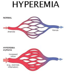 Inflammation and the Healing Process