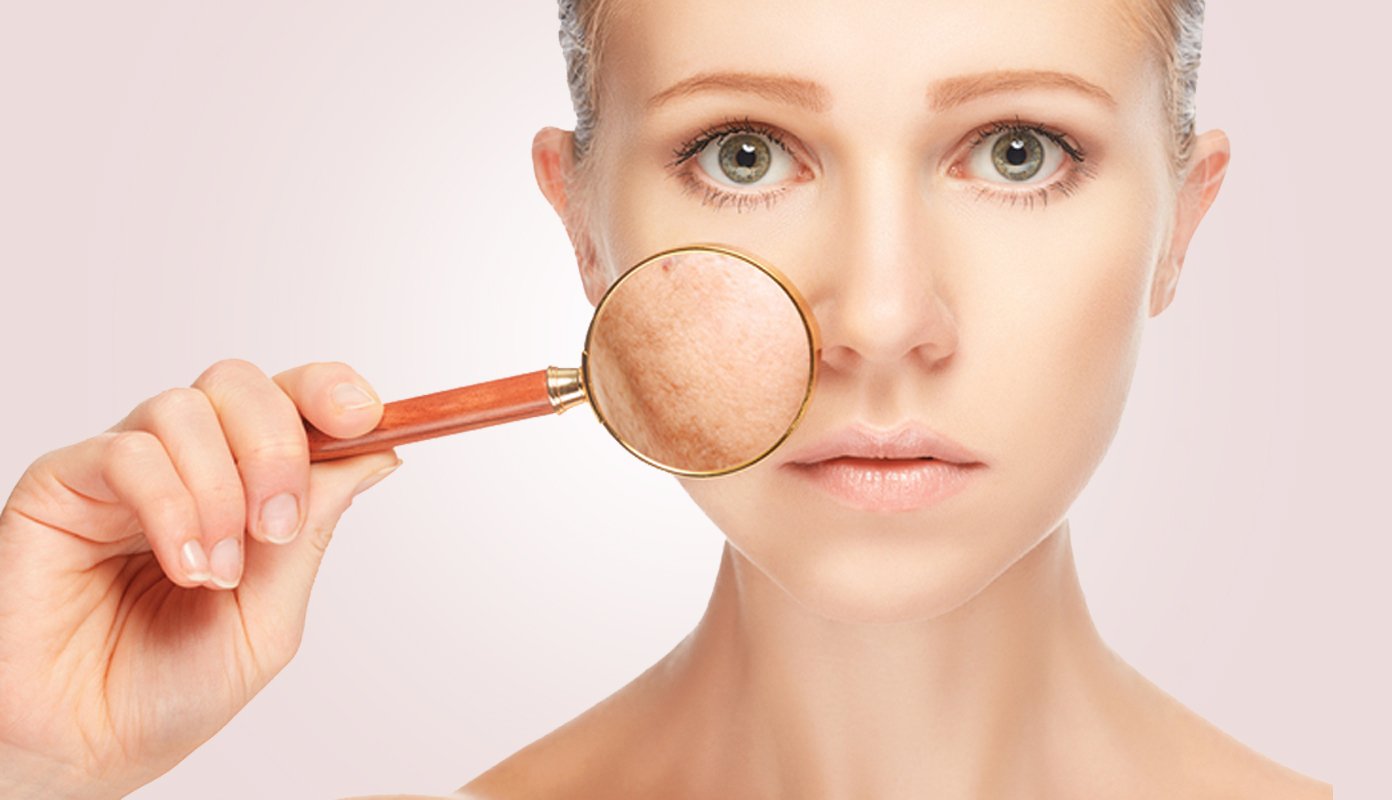 Intertrigo Candidiásico | Derma San Martin | San Isidro